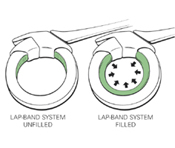 Care & Treatment | Buffalo General Medical Center/Gates Vascular ...